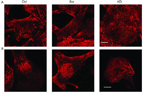 Immunofluorescent Detection Of Septin7 In Non Migrating And Migrating