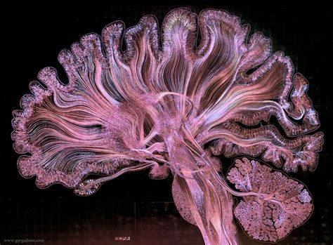 Scientific Art Of Colorful Brain Scans Has Over Gold Leaf Pieces