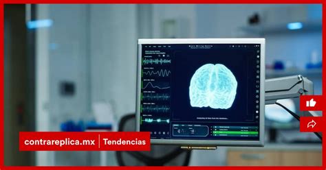 Tiene Neuralink Aprobación De La Fda Para Implantes Cerebrales En