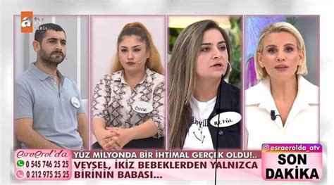 Aldatma Hikayesi Esra Erolda Gün Yüzüne Kavuştu Tıp Dünyasını Hayrete