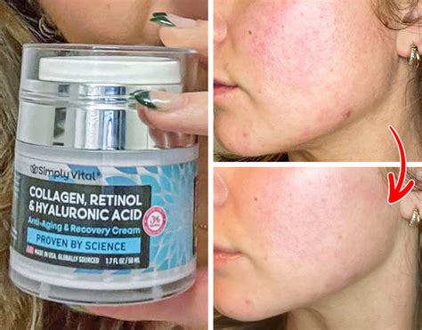 10 Most Wished For Amazon Gems That Can Quickly Reset Your Stressed Skin Bright Side