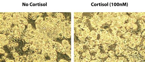 Effect Of Cortisol On Pre Adipocyte Differentiation 3t3 L1 Cells Were