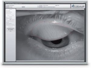 Oculus Keratograph 5M Corneal Topography Keratometer Blue River