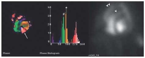 Nuclear Cardiology Radiology Key