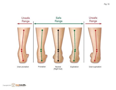 Supination Vs Pronation Plantar Mortons Neuroma Foot Exercises