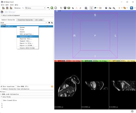 github shine636363 cmr4slicer