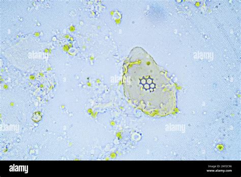 Water Under Microscope Hi Res Stock Photography And Images Alamy