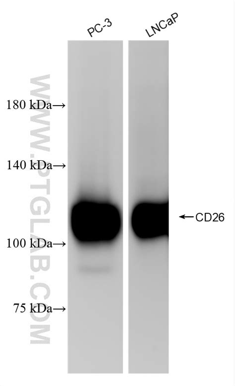 Dpp4 Cd26 Antibody 84606 6 Rr Proteintech