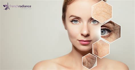 The Benefits Of Microneedling Microneedling Results