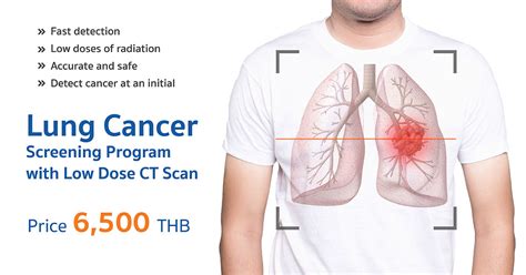 Lung Cancer Screening Program With Low Dose Ct Scan Vejthani Hospital