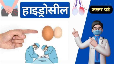 हाइड्रोसील का कारण लक्षण और ईलाज Hydrocele In Hindi