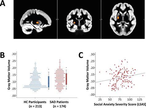 Multi Center Mega Analysis Of Brain Structure In Social Anxiety