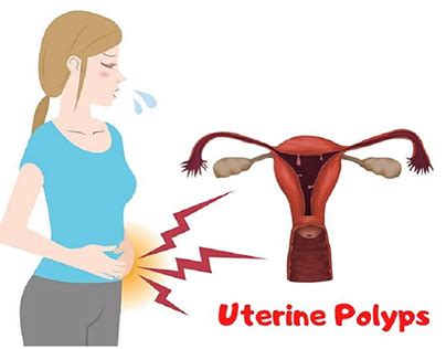 Polyps Projects Photos Videos Logos Illustrations And Branding On Behance