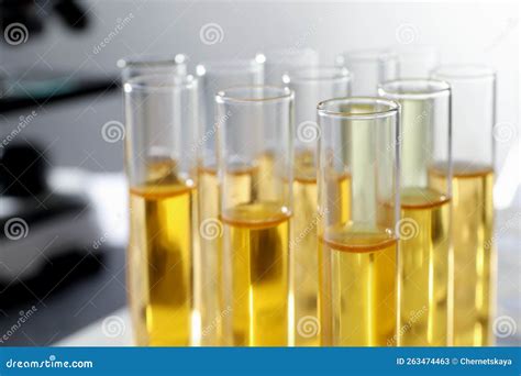 Tubes With Urine Samples For Analysis In Laboratory Closeup Stock