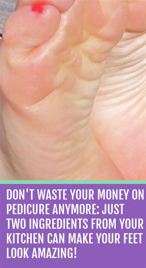 10 Nail Symptoms And What They Mean For Your Health You Shouldnt