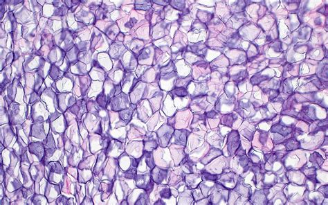 Anucleated Squamous Cells Light Micrograph Stock Image C061 4113 Science Photo Library