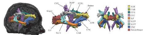 Figure 1 From Sex Differences In White Matter Pathways Related To