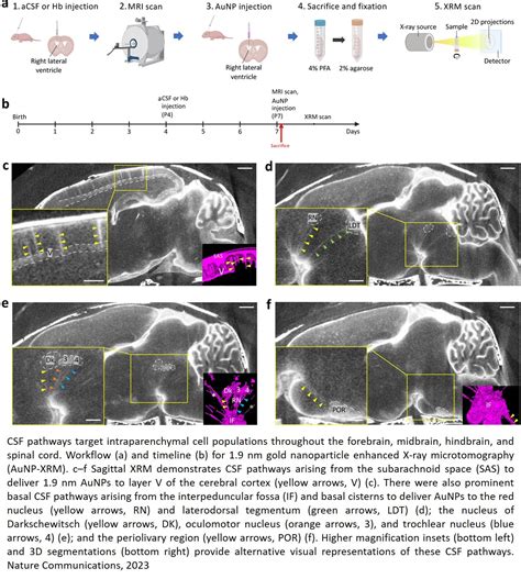 Disrupted Flow Of Brain Fluid May Underlie Neurodevelopmental Disorders