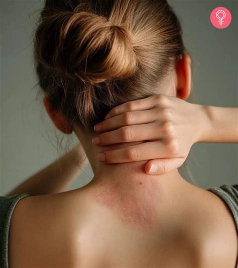 Hiv Aids Symptoms Rash Are Hives A Symptom Of Hiv