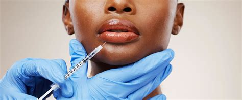 Dissolving Filler Rena Clinics