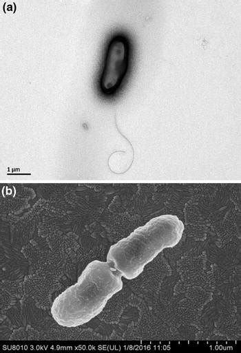 Polar Lipid Profile Of Strain 36 5 1t After Two Dimensional Tlc And
