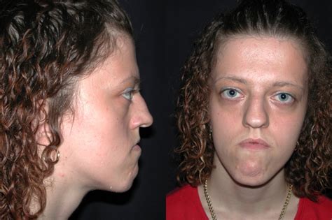 Clinical Case Album On Imgur