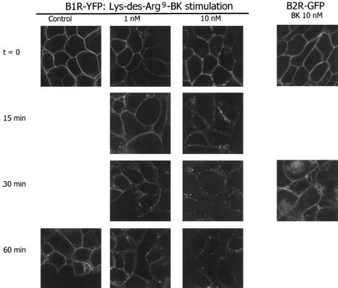 Subcellular Localization Of The B 1 R Yfp Fusion Protein In Stably