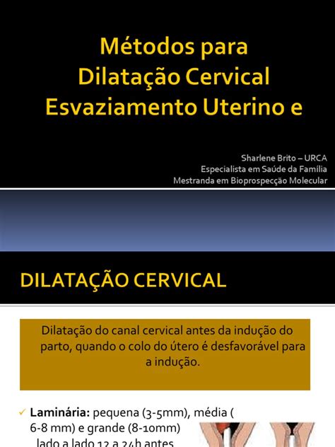 Dilatação Cervical E Curetagem Download Free Pdf Aborto Rtt