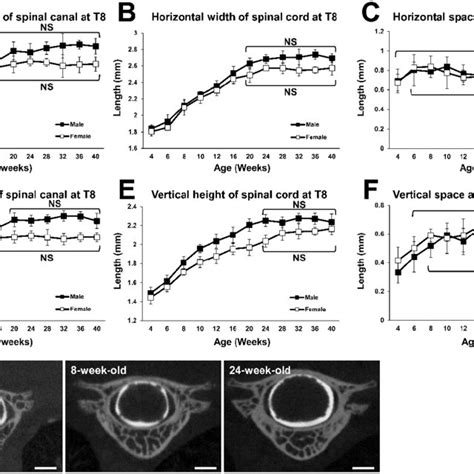 Growth Curves For The Spinal Canal And The Spinal Cord At T8 A