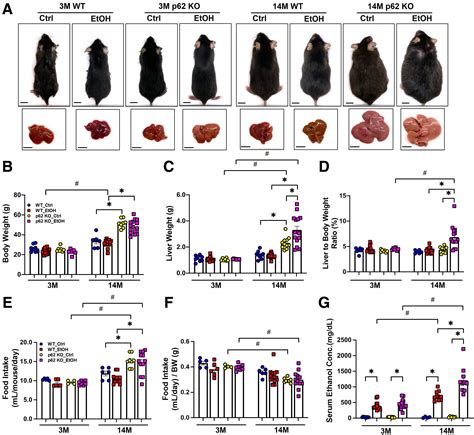 Loss Of Sqstm1 P62 Induces Obesity And Exacerbates Alcohol Induced