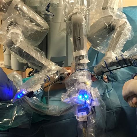 Port Incisions For Right Sided Robotic Thymectomy Download Scientific Diagram