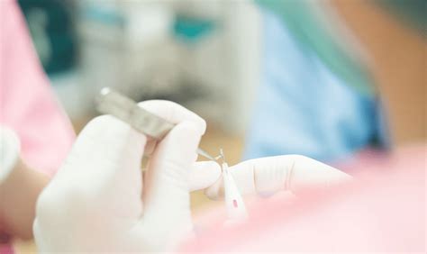 ปลูกผม Dhi กับ Fue ต่างกันอย่างไร เลือกปลูกผมวิธีไหนดี