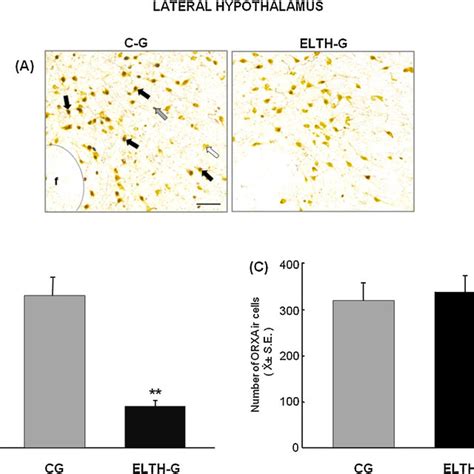 Fos Expression In Cerebellar Cells Representative Photomicrographs Of
