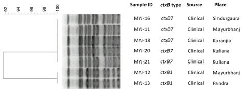 Pulsed Field Gel Electrophoresis Pfge Analysis Of V Cholerae O1