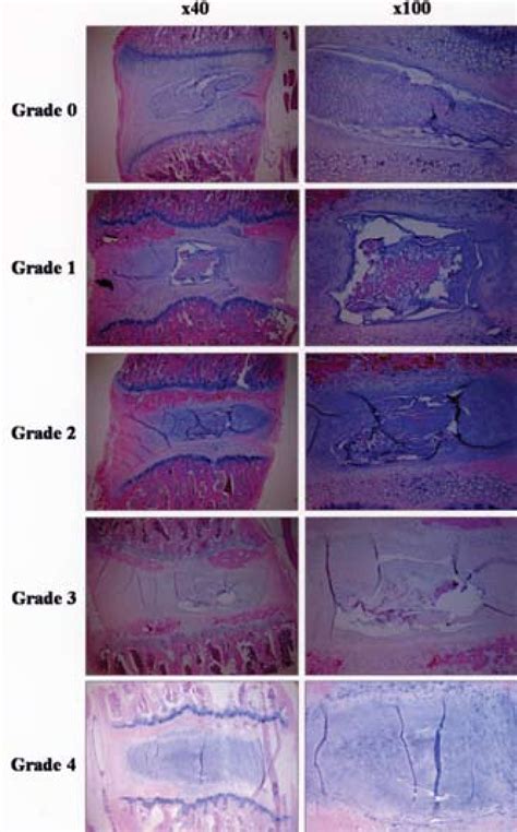 Figure 1 From Effect Of Hyperglycemia On Apoptosis Of Notochordal Cells