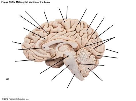 Midsagittal Section Of Brain Diagram Quizlet
