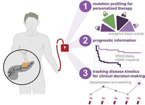 Circulating Tumor Dna Toward Evolving The Clinical Paradigm Of