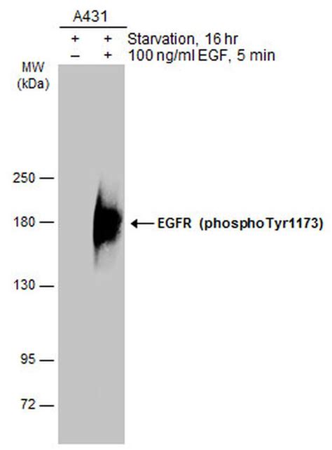 Phospho Egfr Tyr1173 Monoclonal Antibody Gt1111 Ma5 38257