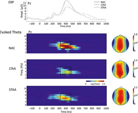 Theta Event‐related Synchronization Is A Biomarker For A Morbid Effect Of Alcoholism On The