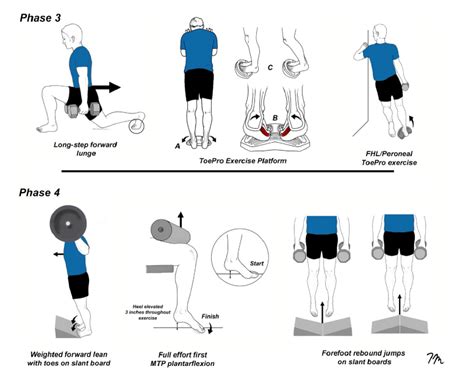 Treatment And Prevention Of Turf Toe