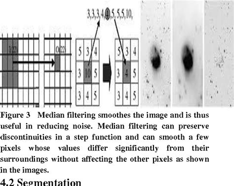 Figure 3 From A Kannada Document Image Retrieval System Based On