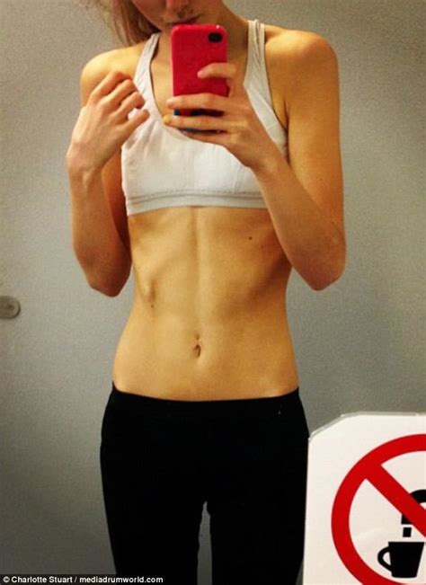 Anorexia Sufferer Whose Weight Plummeted To Six Stone Daily Mail Online