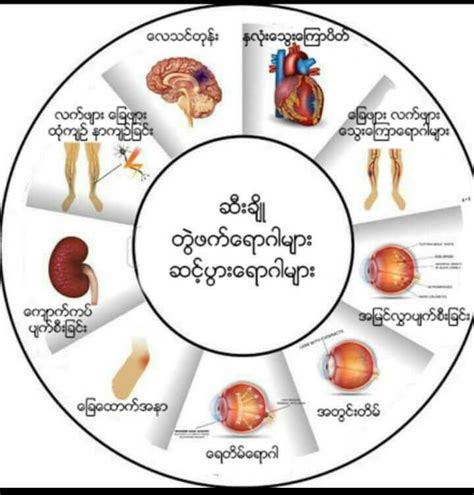 ဆီးချိုသွေးချို အကြောင်းသိကောင်းစရာ Home