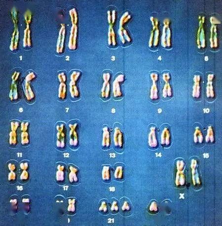 人类细胞染色体为46条是谁发现的？ 蒋有兴 遗传学 瑞典隆德大学