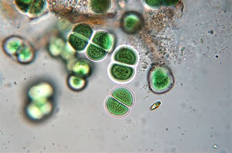 Chroococcus Algues Microscopiques Iii Mikroscopia