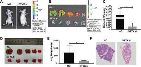 Styx Affects The Tumor Metastasis Of Gc In Vivo A B Bgc 823 Cells