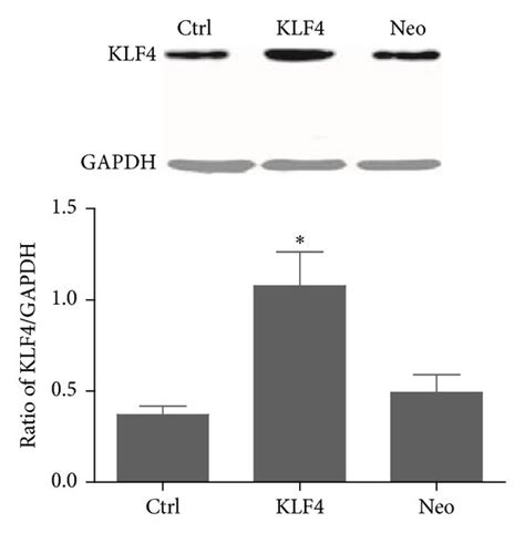 Klf4 Overexpression Induces Il 6 Expression In Ra Flss Ra Flss Were