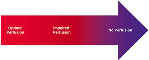 Perfusion Flashcards Quizlet