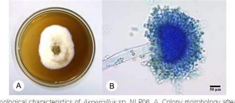 Figure 1 From Isolation And Screening Of Cellulase Producing Fungi For