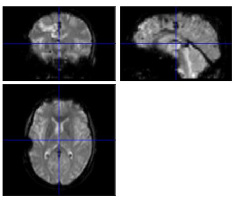Nuisance Regression The R Fmri Network